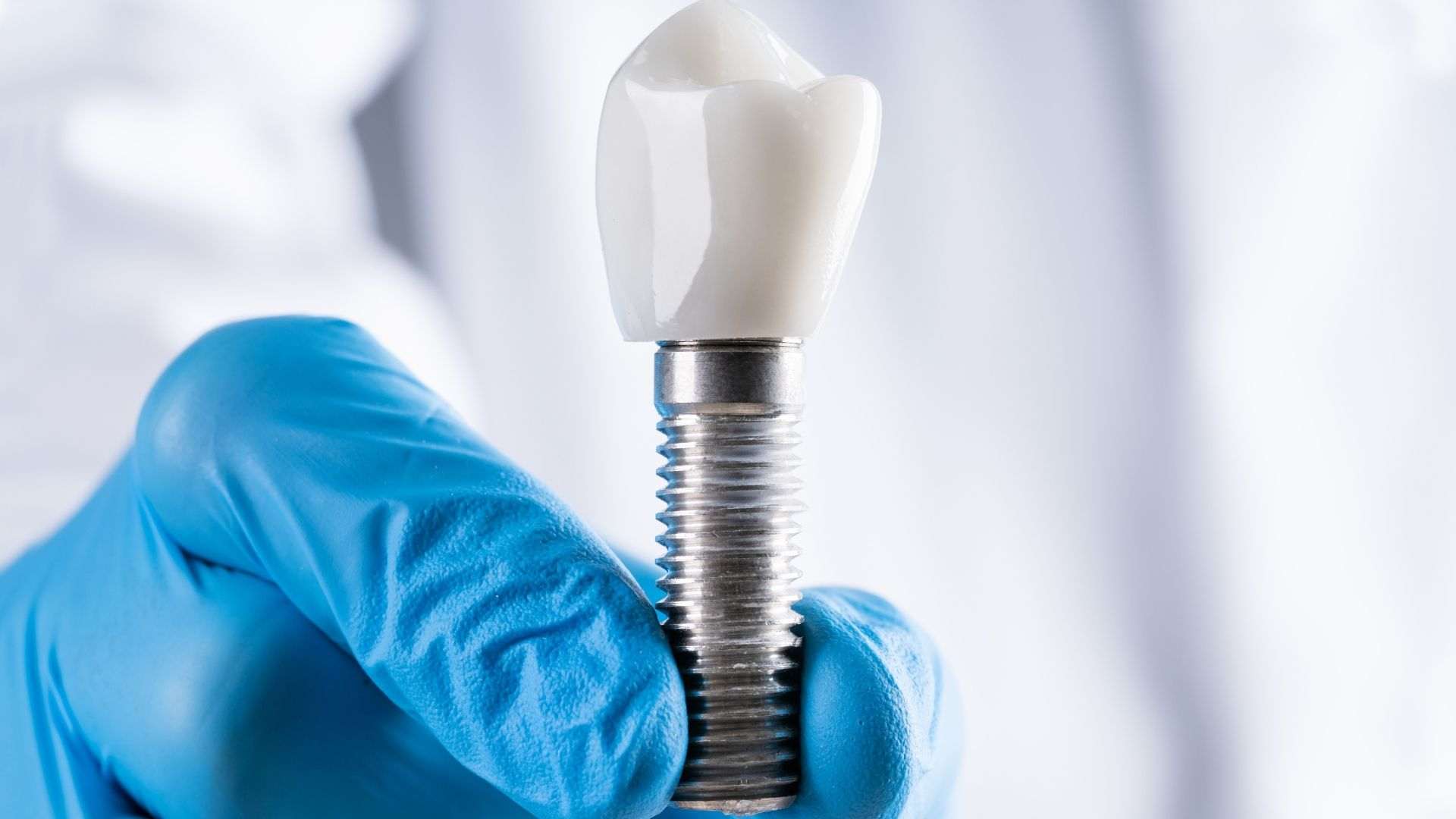 ZAŠTO ODABRATI DENTICO ZA UGRADNJU ZUBNIH IMPLANTATA? - Fenix Magazin